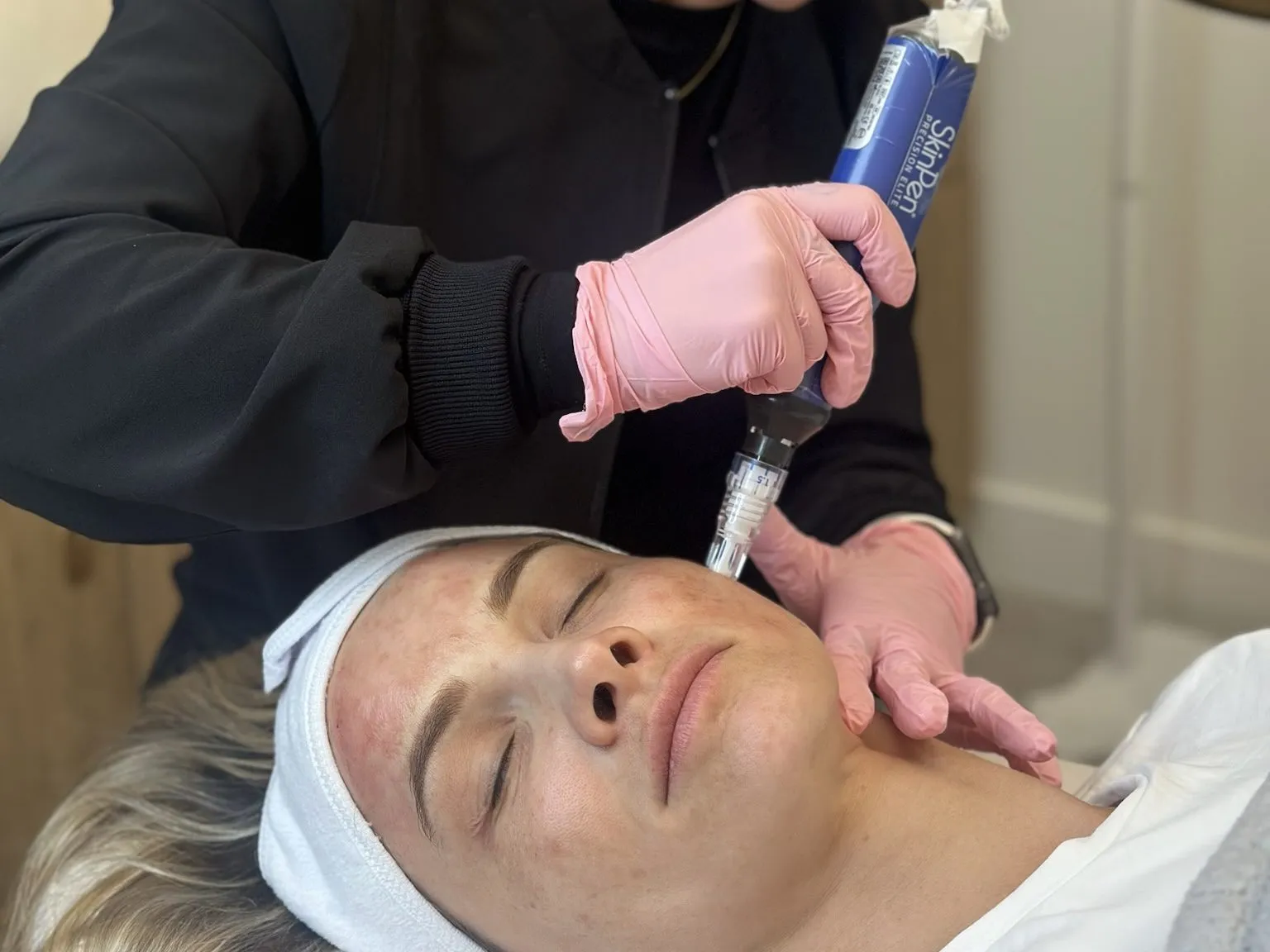 Contour Salon & MedSpa | Professional Microneedling